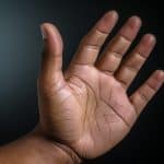 Phalange du doigt gonflée : causes courantes et traitements efficaces ...
